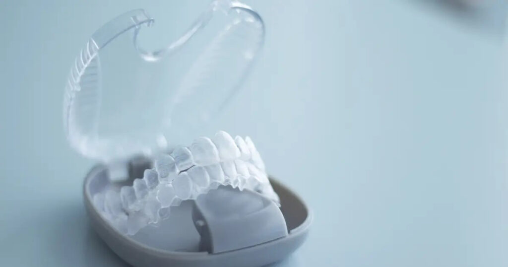 A Comprehensive Guide to Retainers